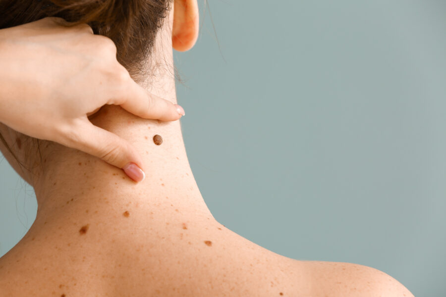 Events – The Dermatology Partnership